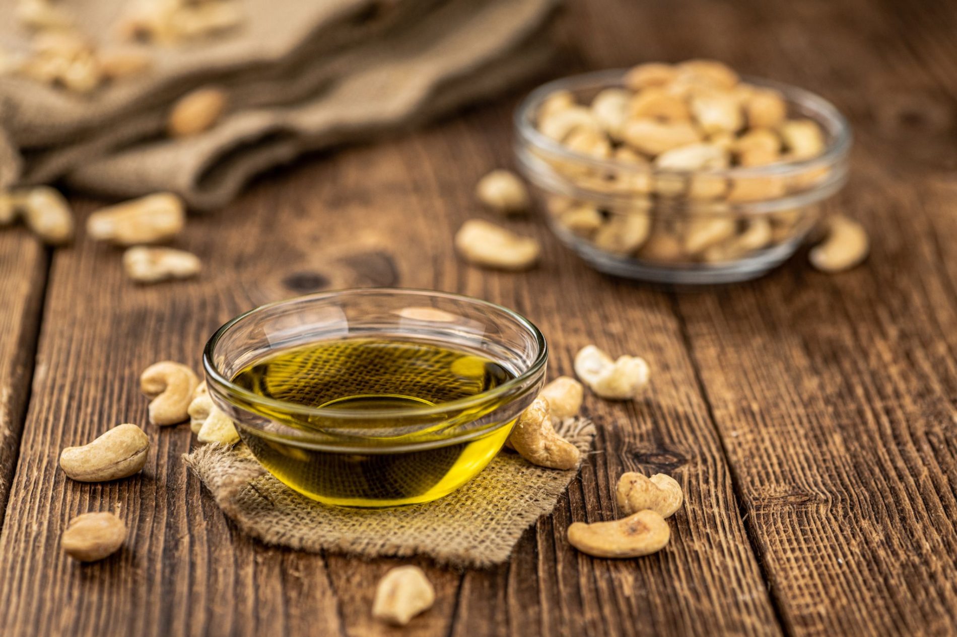 Anacardos: qué son, propiedades, calorías y beneficios - Manzanaroja Dieta